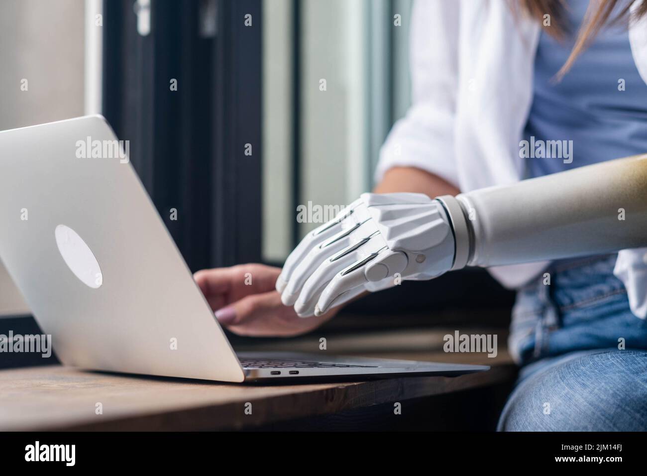 Motivated woman using prosthetic arm working notebook computer, typing ...
