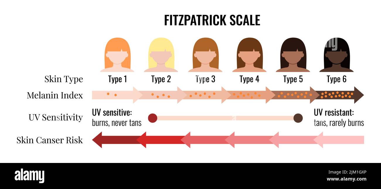 Fitzpatrick skin tone scale phototype melanin index with female avatar ...