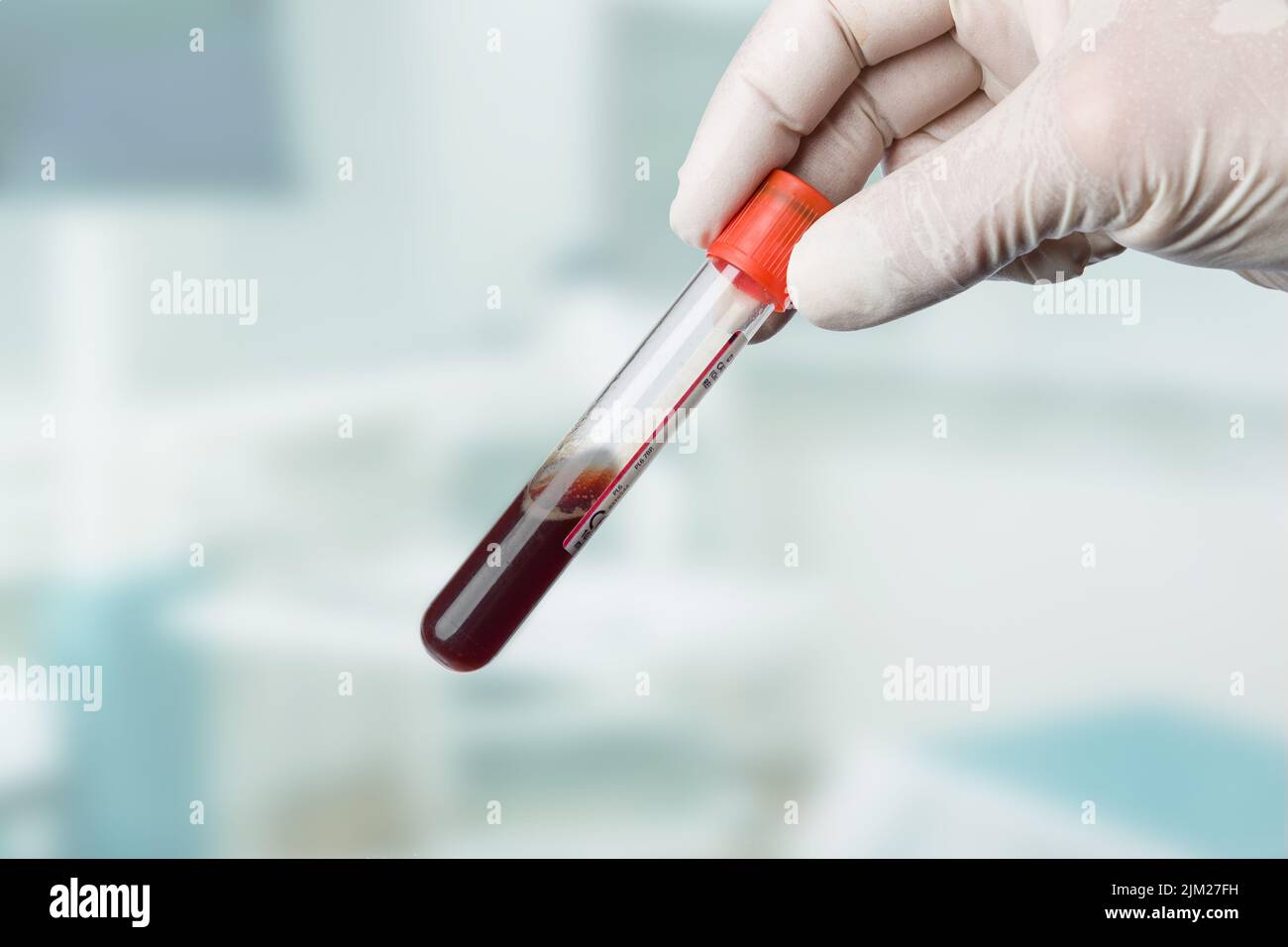 close-up of doctor's hand in wearing medical gloves handling a blood ...