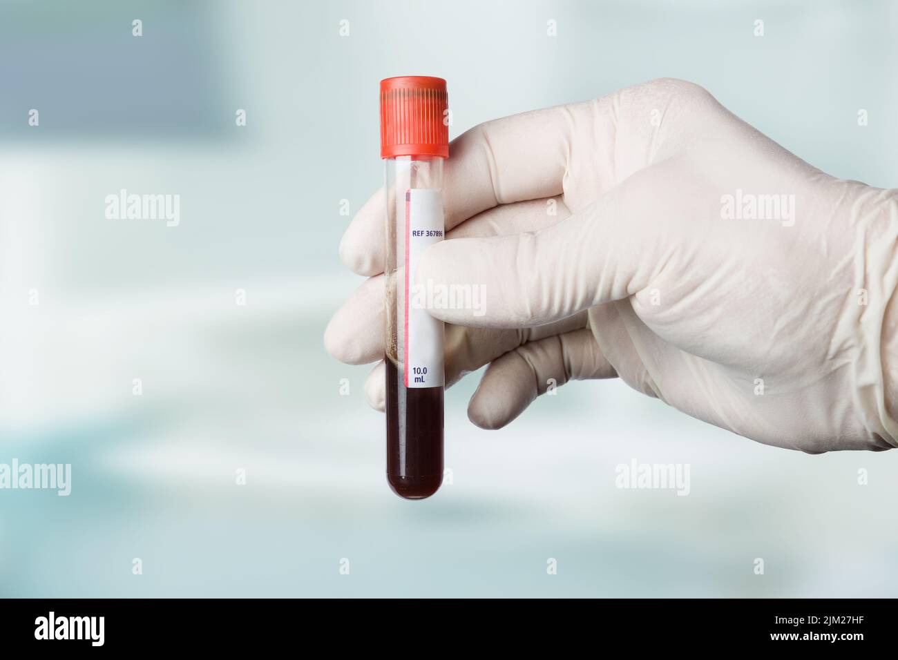 close-up of doctor's hand in wearing medical gloves handling a blood ...