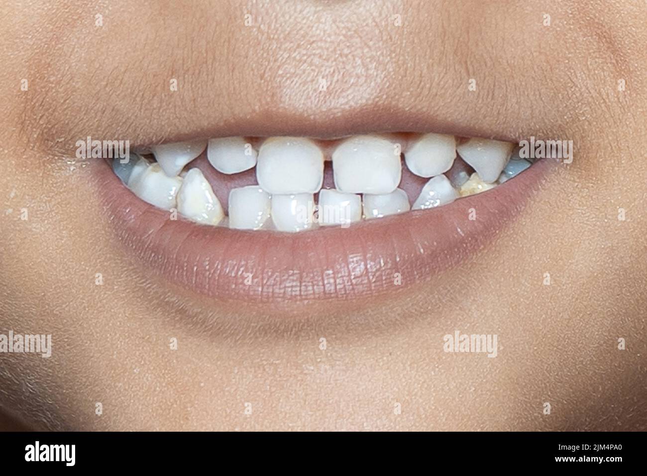 baby smile close. white teeth of a child isolated Stock Photo - Alamy