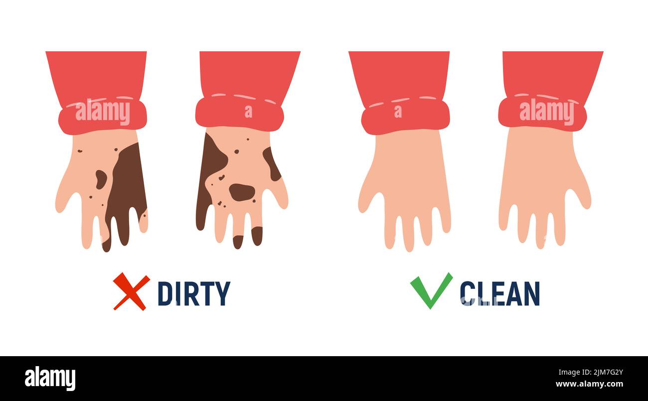 Dirty and clean hand. Hygiene poster. Isolated vector illustration ...