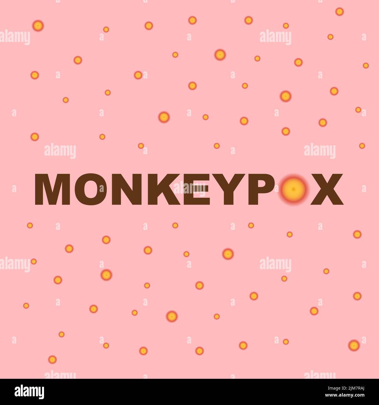 monkeypox text with smallpox spots illustration background vector Stock ...