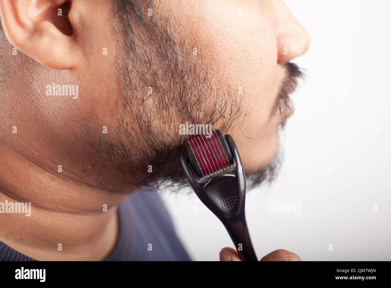 Microneedling, Caucasian male using derma roller for beard growth in ...