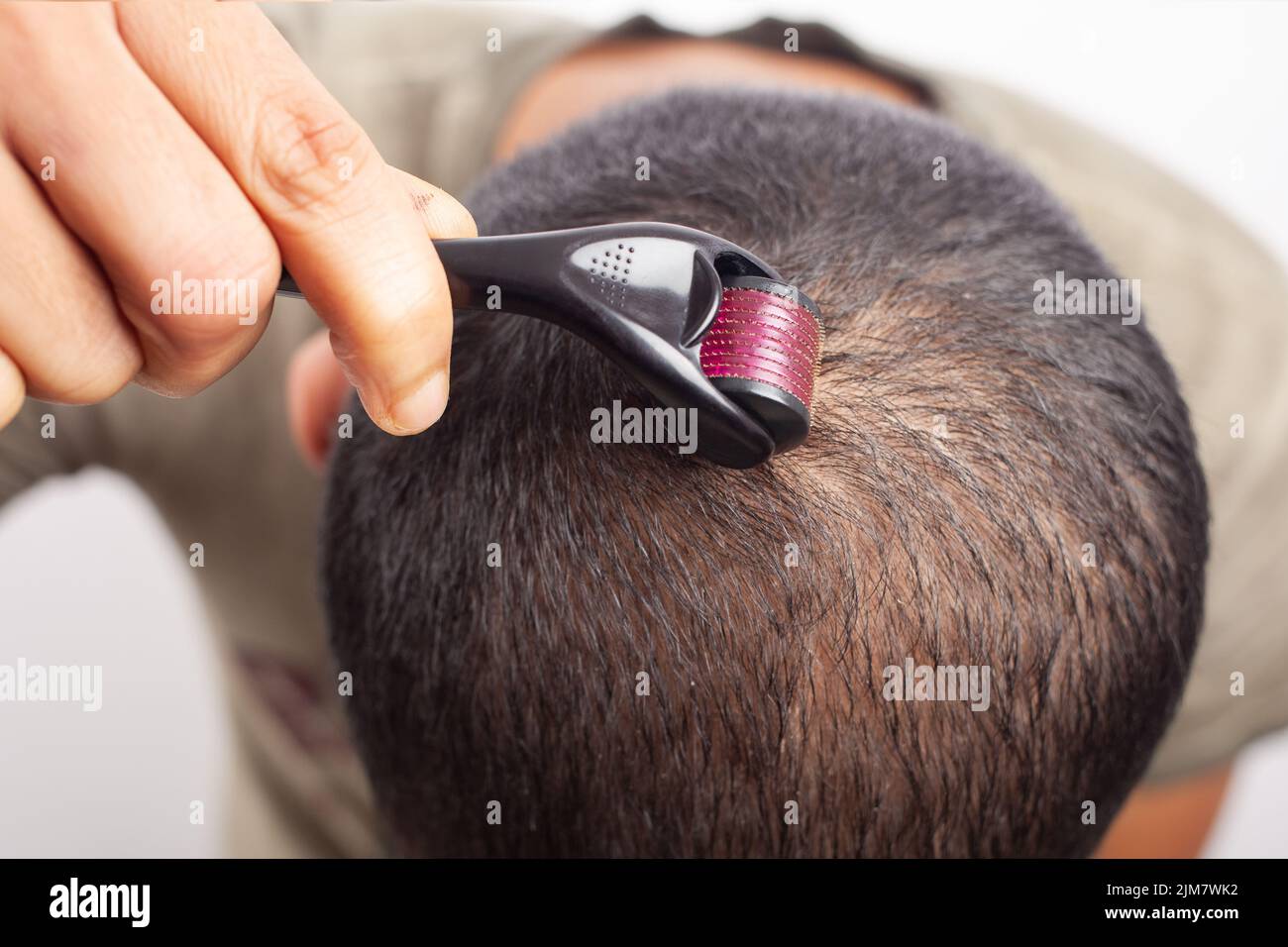 A young man using dermaroller to tackle hair loss and to promote hair ...