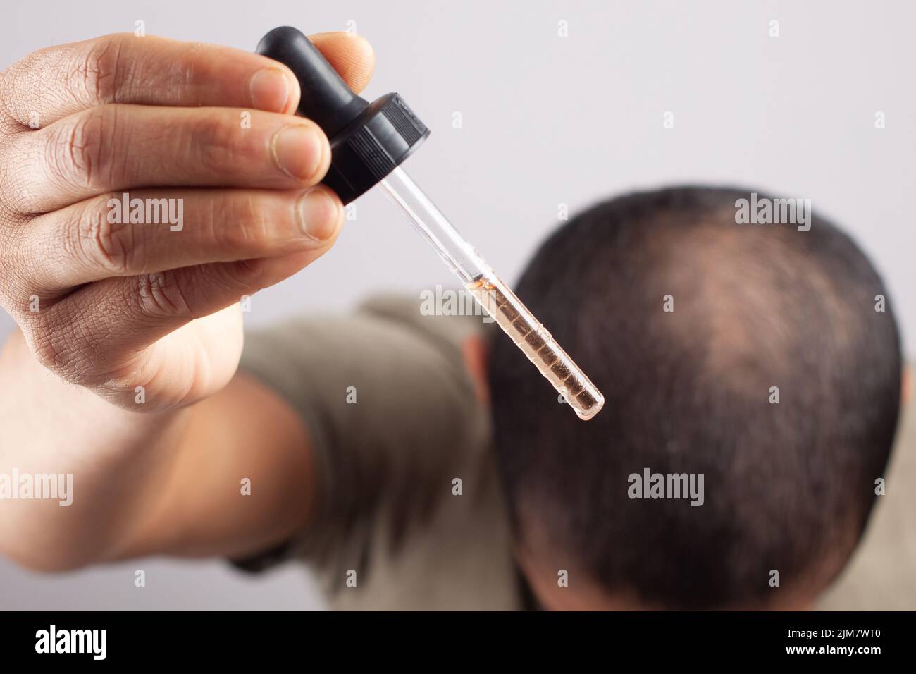 man showing a dropper going to apply hair oil or minoxidil on scalp for ...