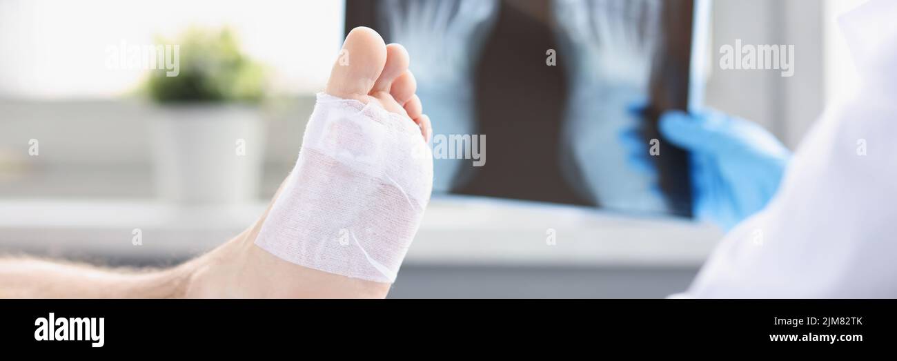 A doctor looks at an x-ray of a man's injured leg, blurry Stock Photo ...