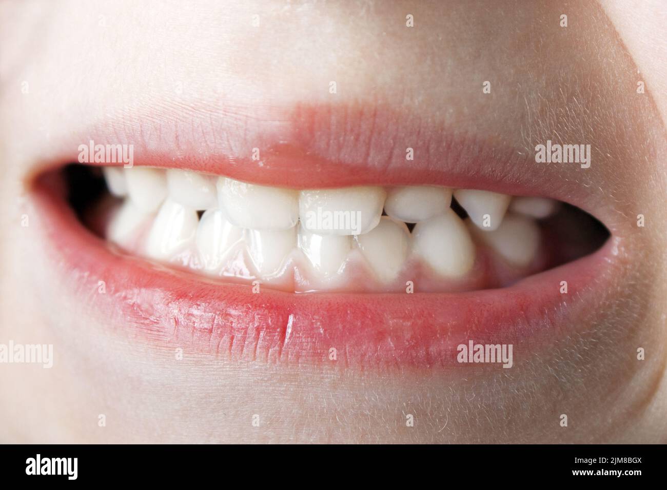 Shiny teeth hi-res stock photography and images - Alamy