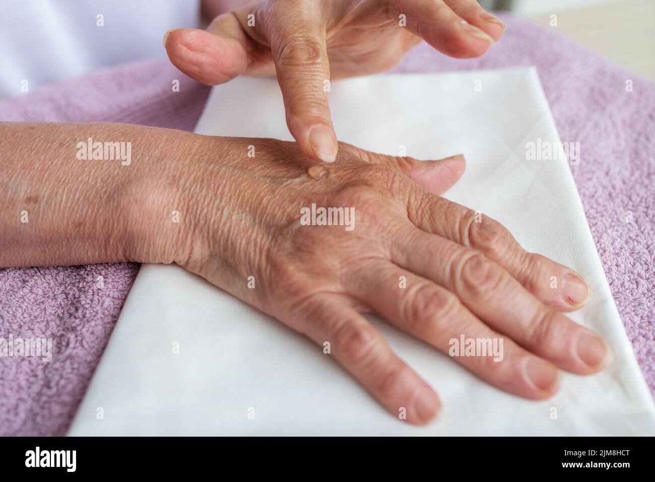 Ointment tube finger hi-res stock photography and images - Alamy