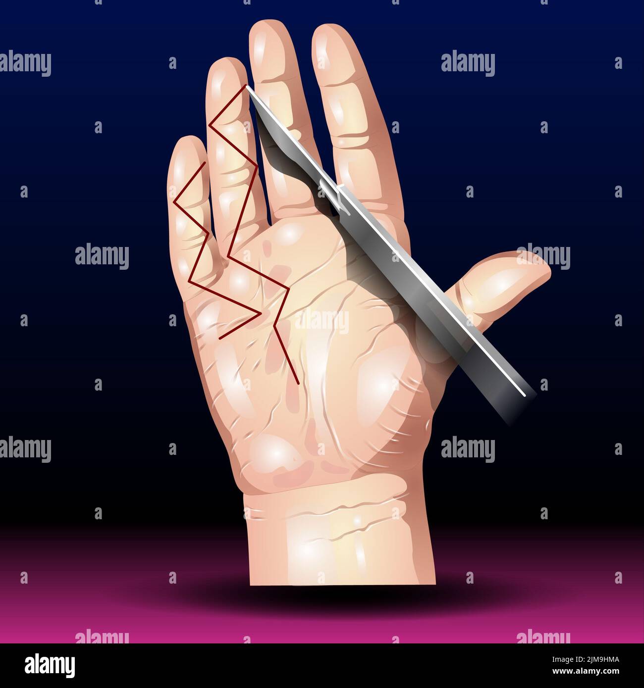 Surgical tool illustration hi-res stock photography and images - Alamy