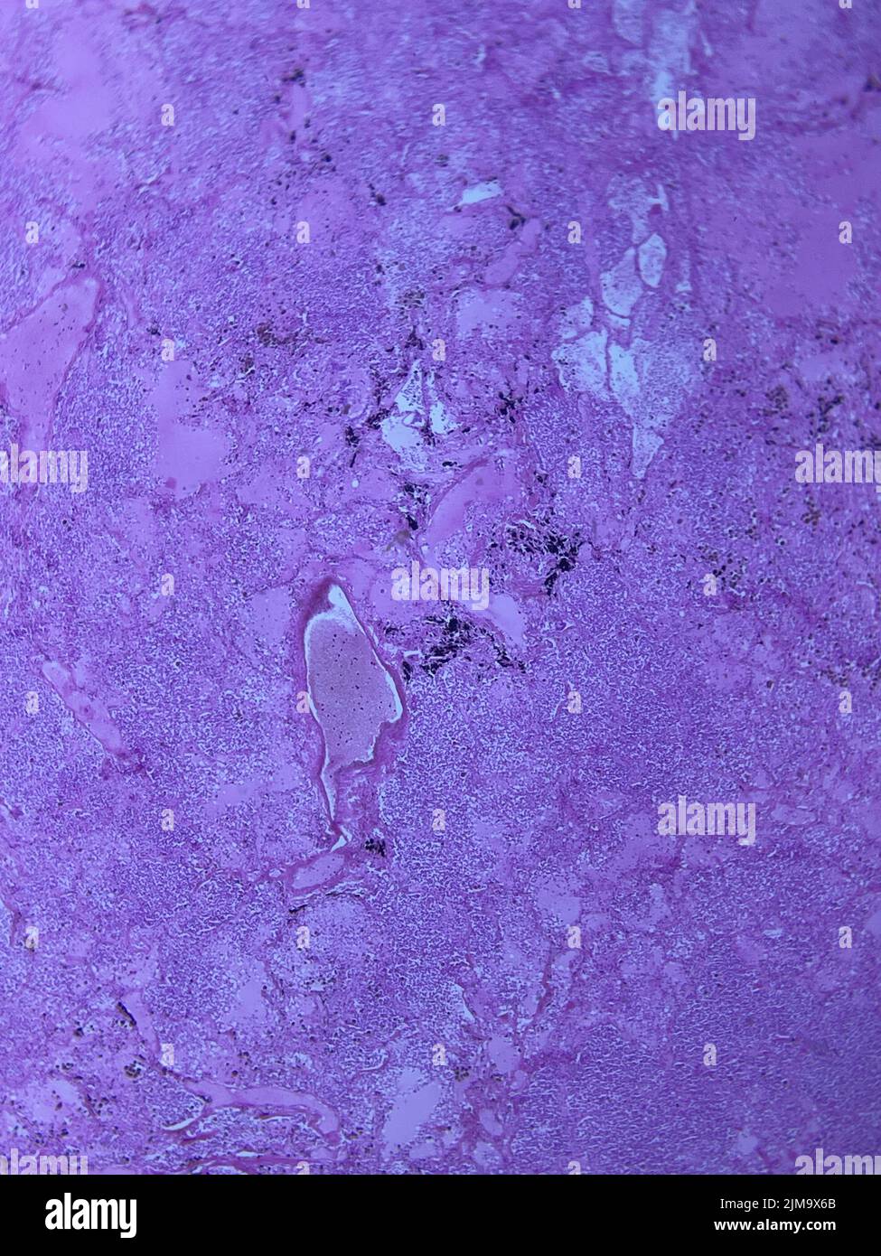 Lung tissue histology in the mobile microscopic view. H and E staining ...