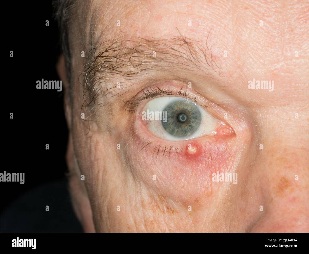 Lower eyelid hi-res stock photography and images - Alamy