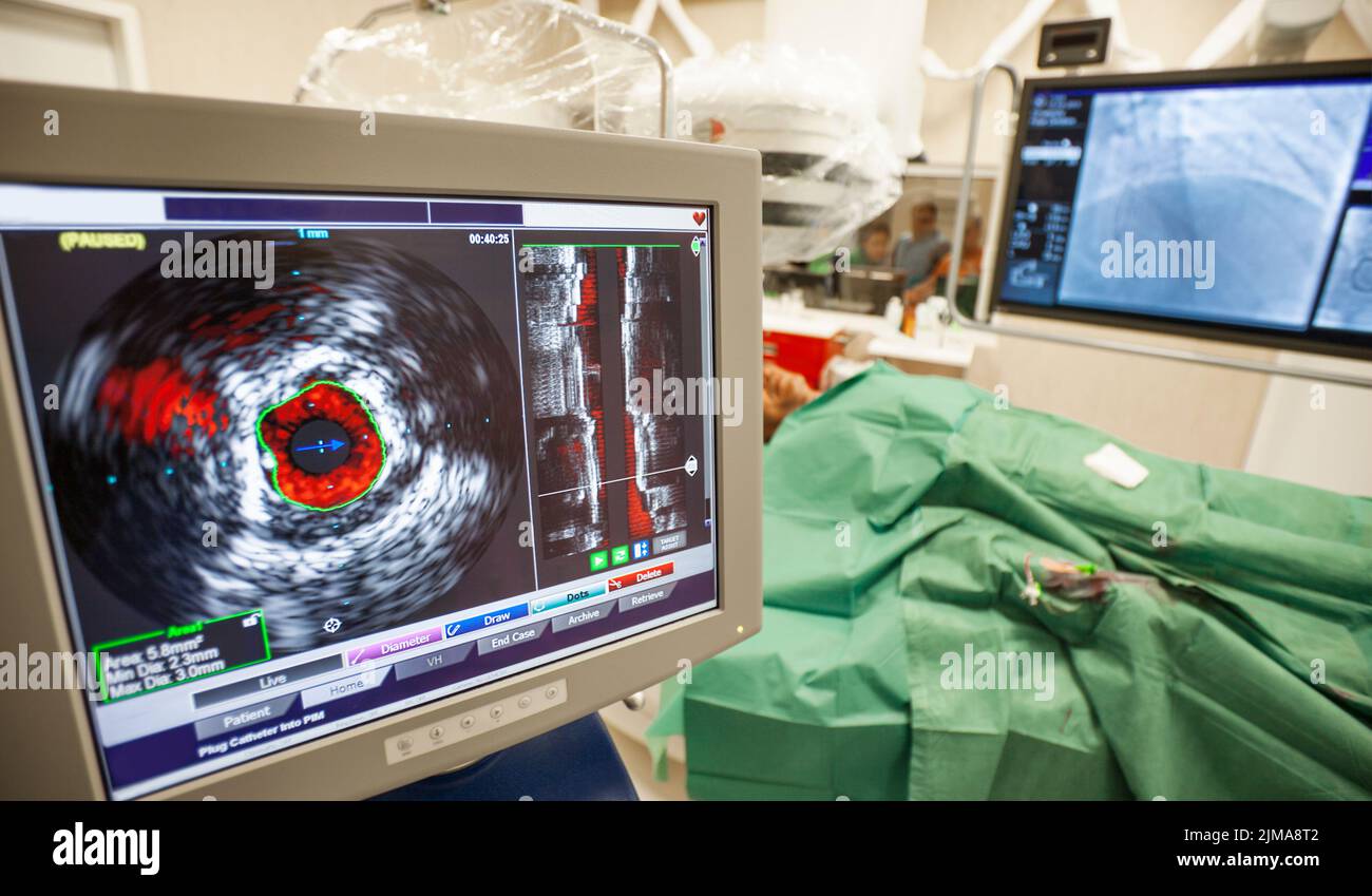 Laparoscopic operation hi-res stock photography and images - Alamy