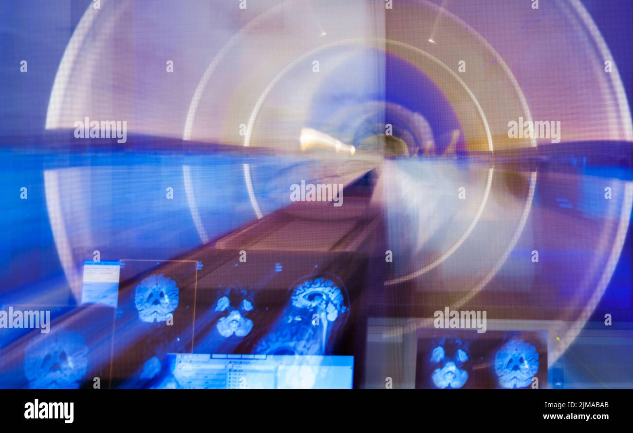 Brain x ray hi-res stock photography and images - Alamy