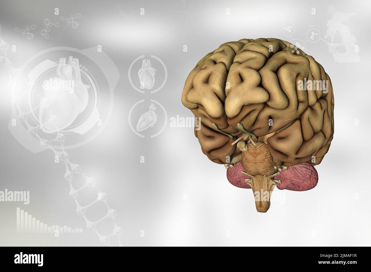 Medical 3D illustration - human brain, alzheimer development concept ...