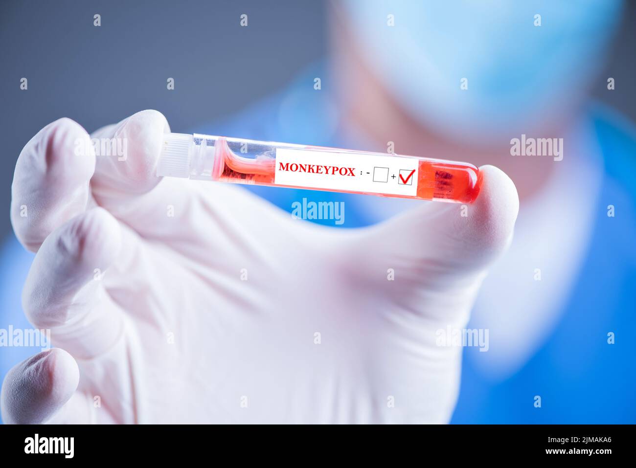 Blood sample positive with Monkeypox virus, new epidemic disease in ...