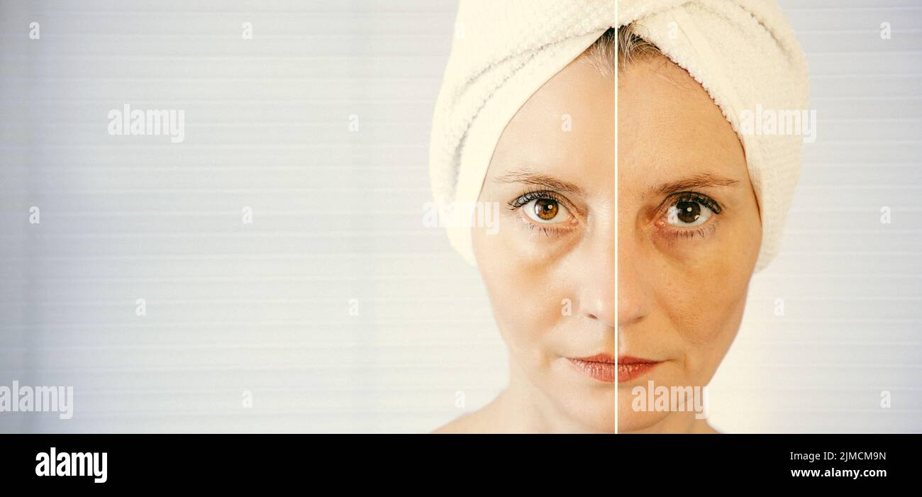 Happy woman after beauty treatment - before/after shots - skin care, anti-aging procedures ...