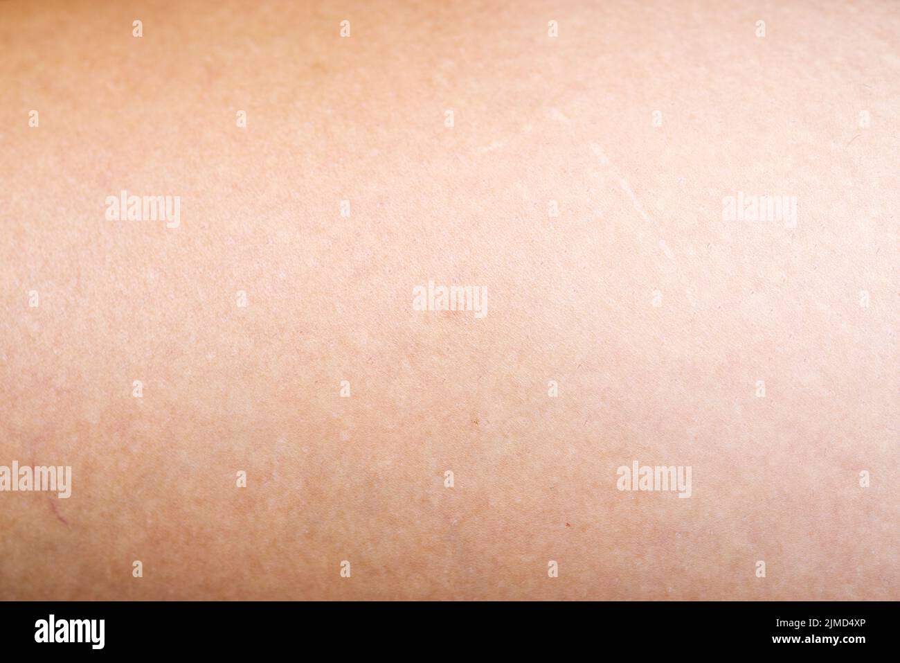 Dappled skin hi-res stock photography and images - Alamy