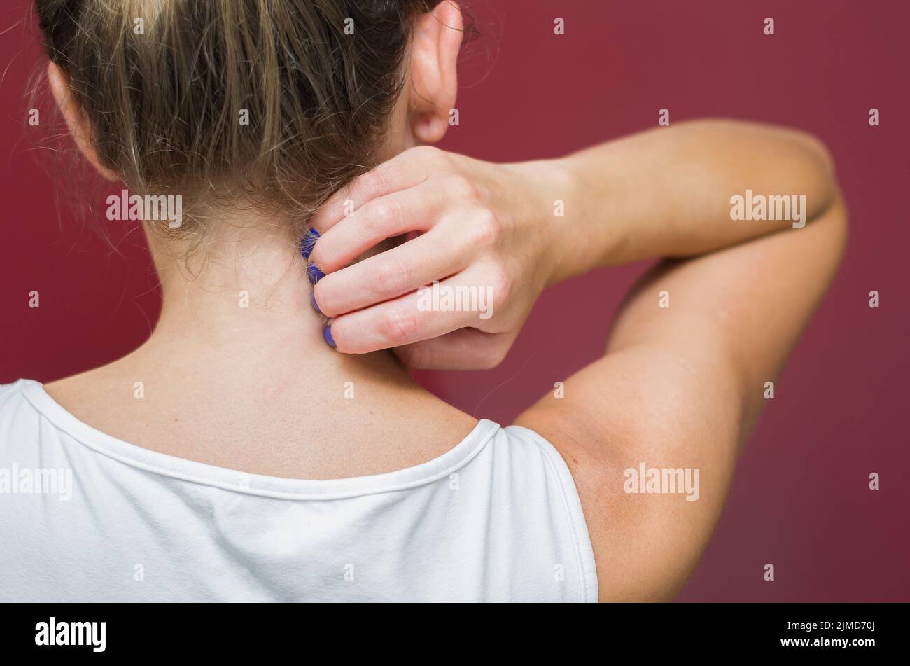 Great concept of allergy and skin diseases, young woman scratching herself Stock Photo - Alamy