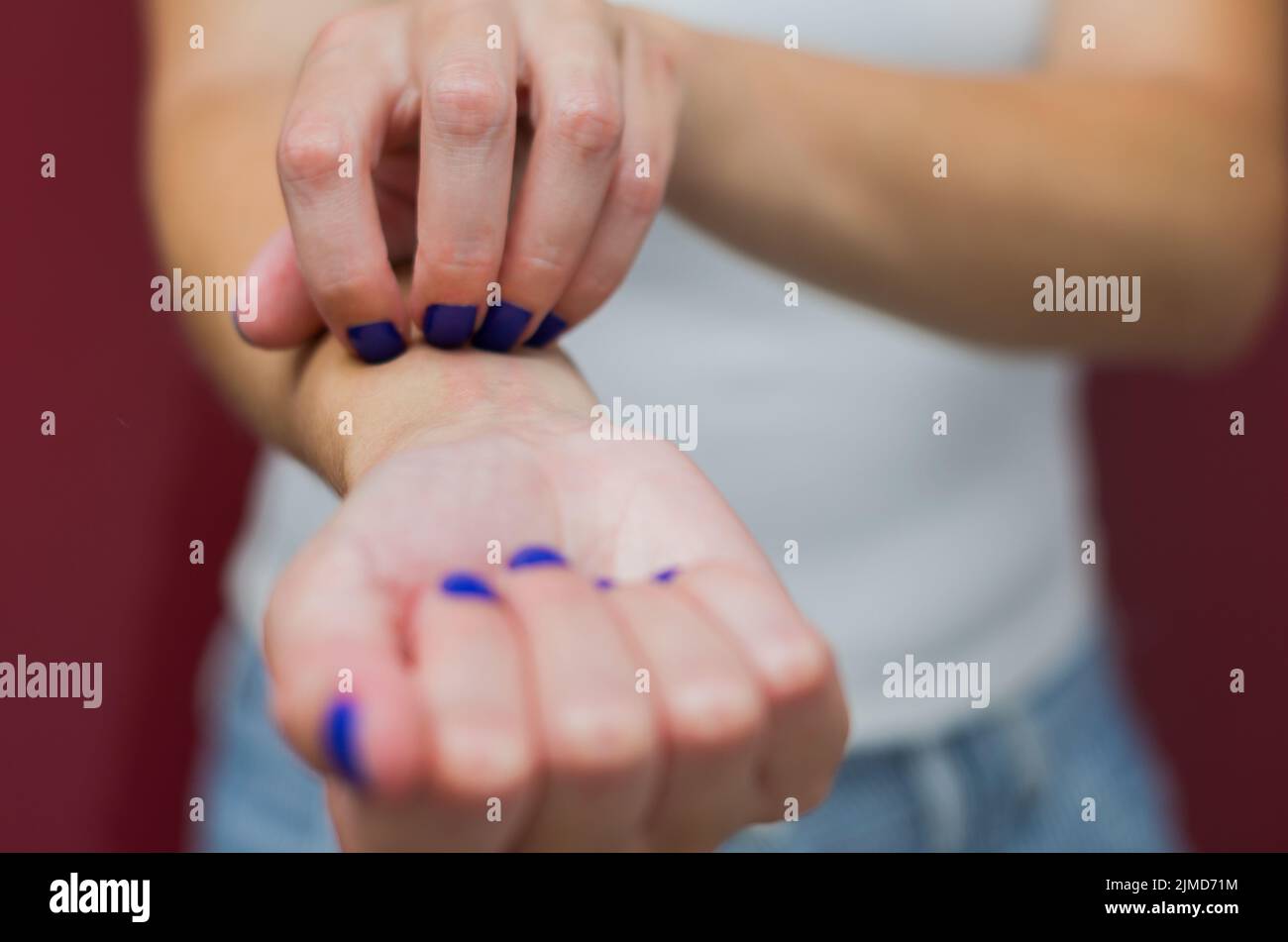 Great concept of allergy and skin diseases, young woman scratching herself Stock Photo - Alamy