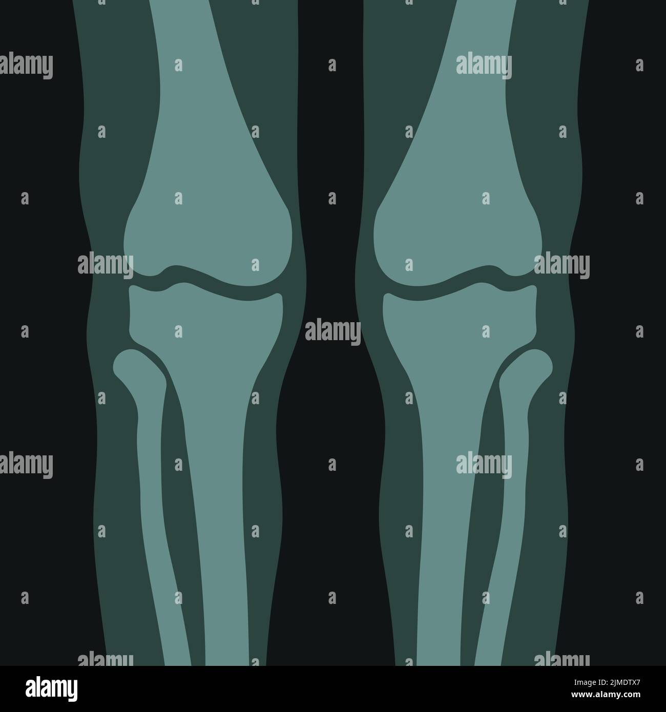 Xray Of Human Body Knees Bones And Joints Vector Stock Vector Image And Art Alamy