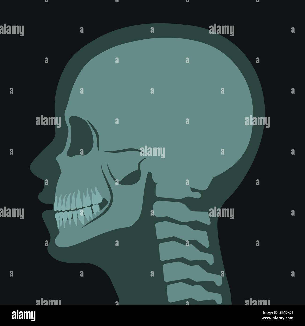 Xray of skull, scan for diagnostics and treatment Stock Vector Image ...