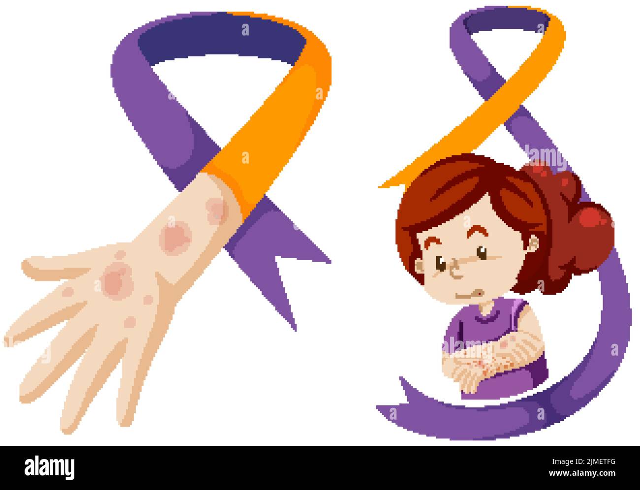 World Psoriasis Day Ribbon Symbol illustration Stock Vector Image & Art ...