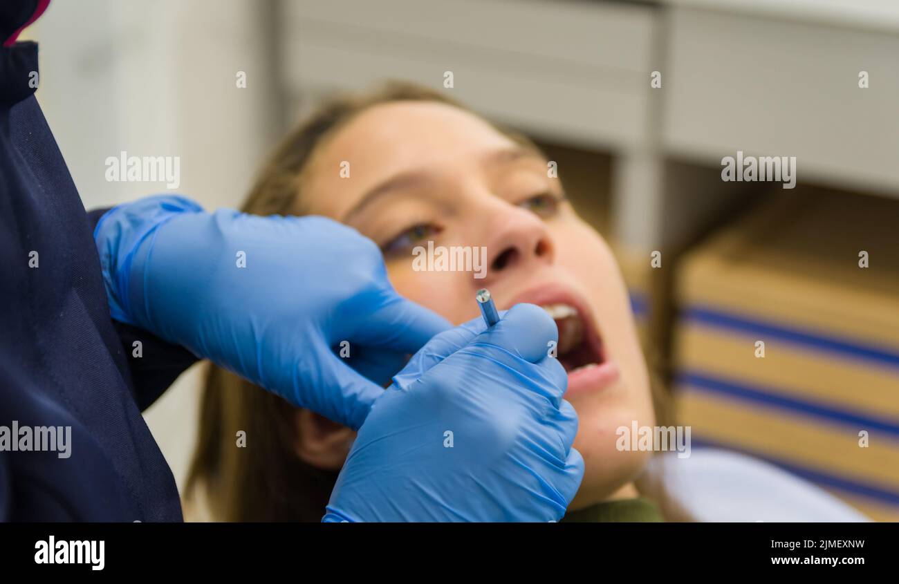 Great concept of dental procedure Stock Photo - Alamy