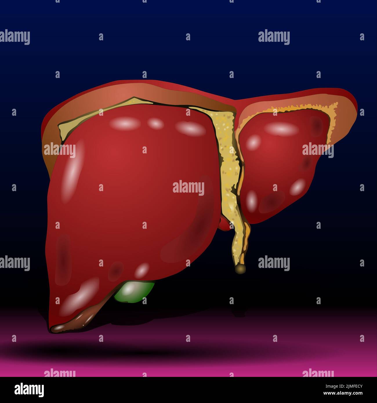 Liver damage hi-res stock photography and images - Alamy