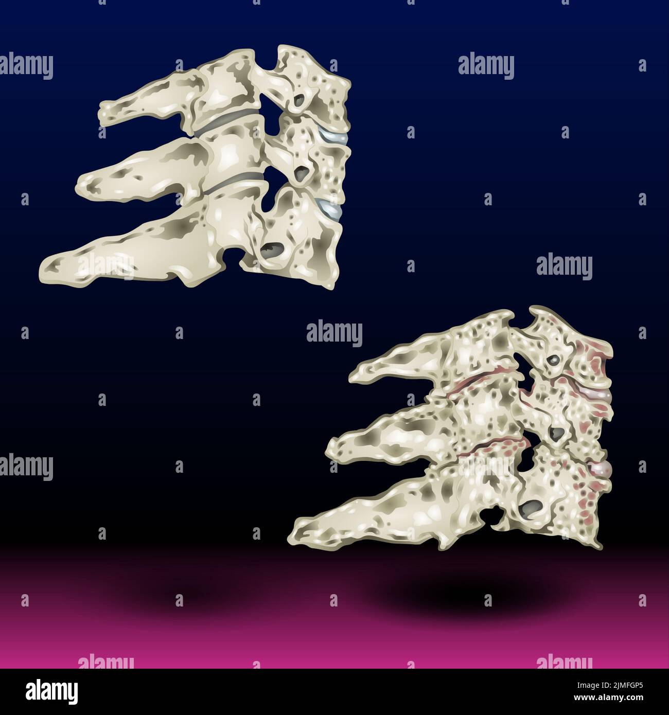 Bone anatomy labeled diagram hi-res stock photography and images - Alamy