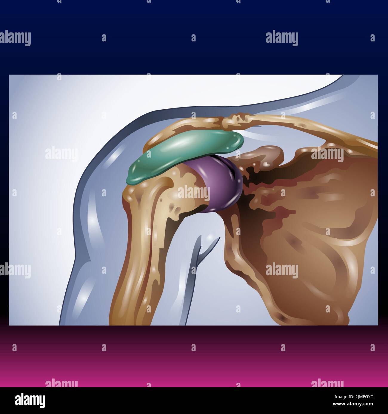 Shoulder bone hi-res stock photography and images - Alamy