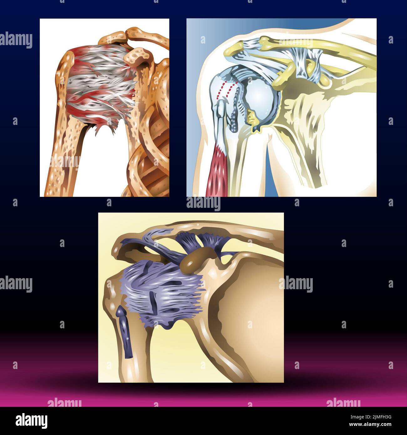 Shoulder anatomy muscle hi-res stock photography and images - Alamy
