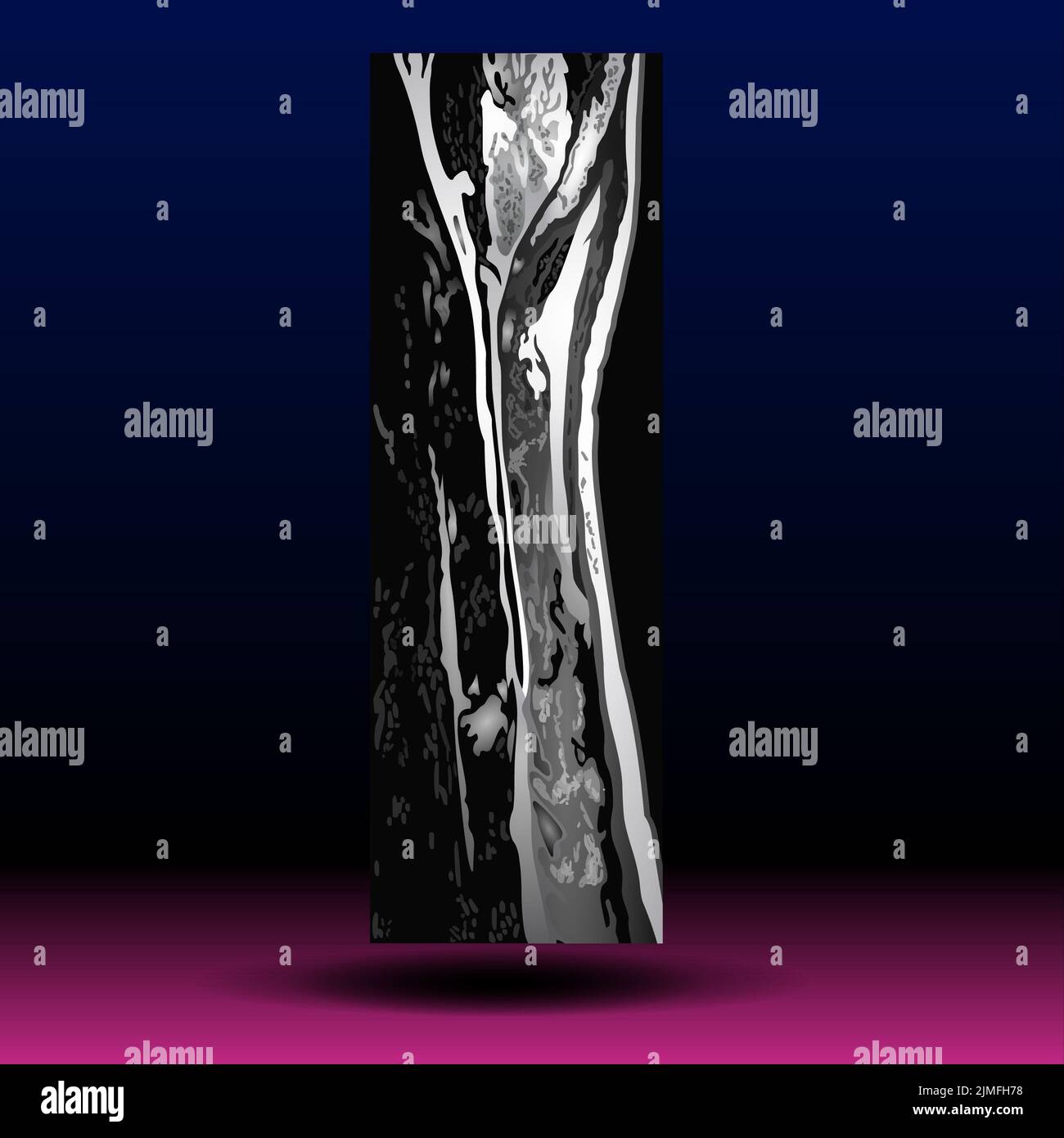 Discitis hi-res stock photography and images - Alamy