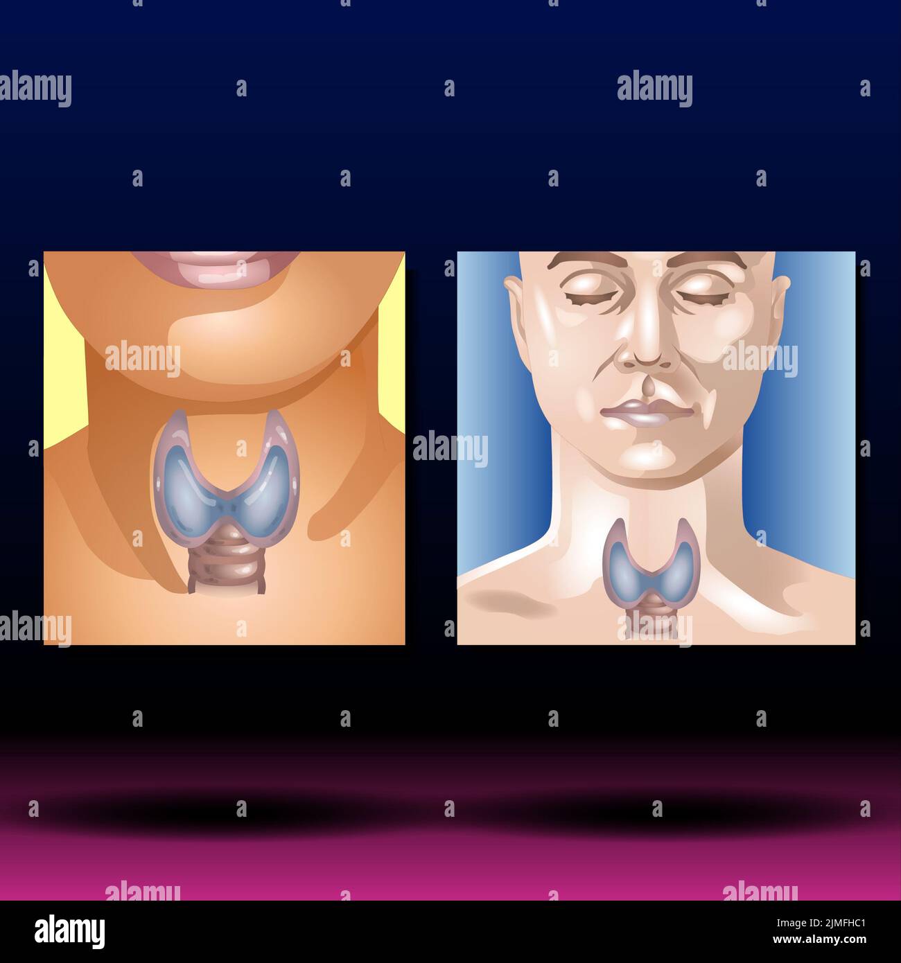 Woman thyroid illustration hi-res stock photography and images - Alamy
