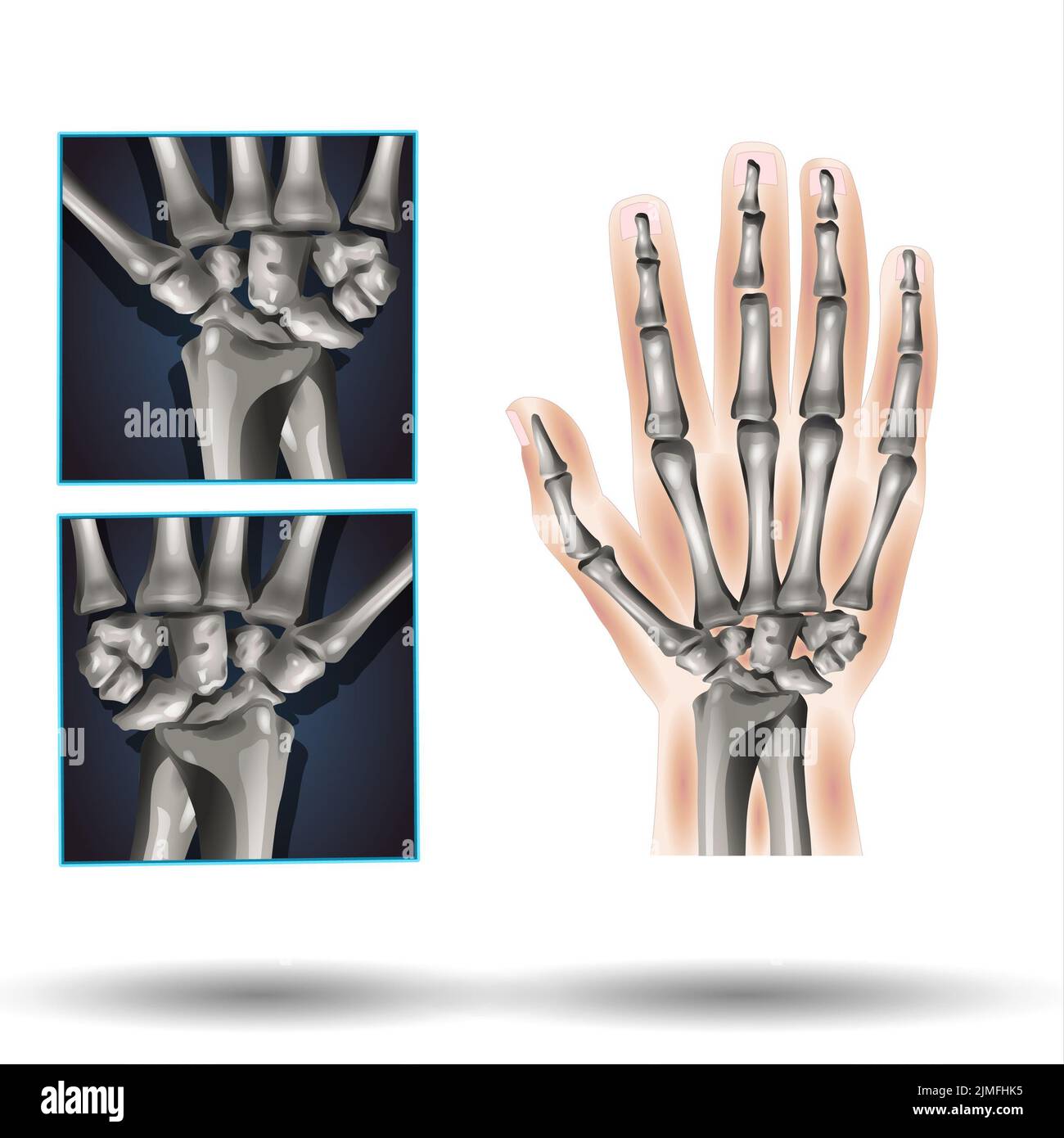 Wrist anatomy hi-res stock photography and images - Alamy