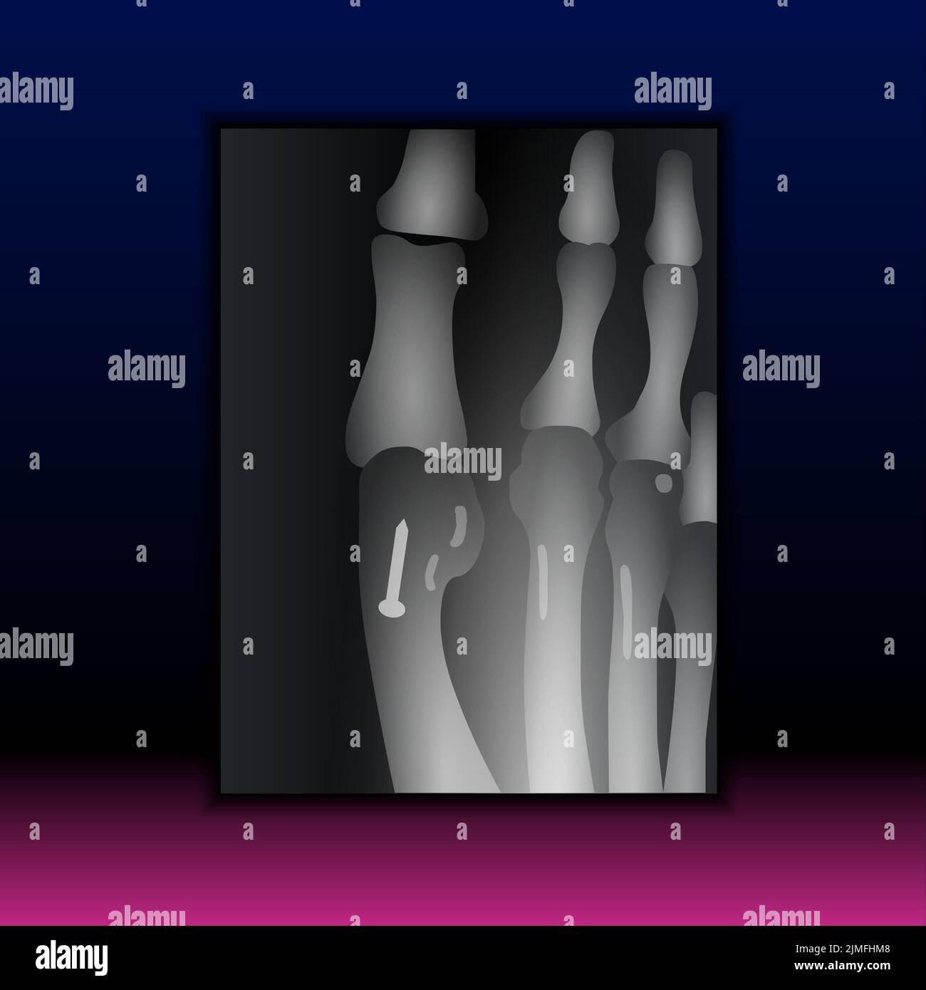 X-ray of Foot Claw Stock Photo - Alamy