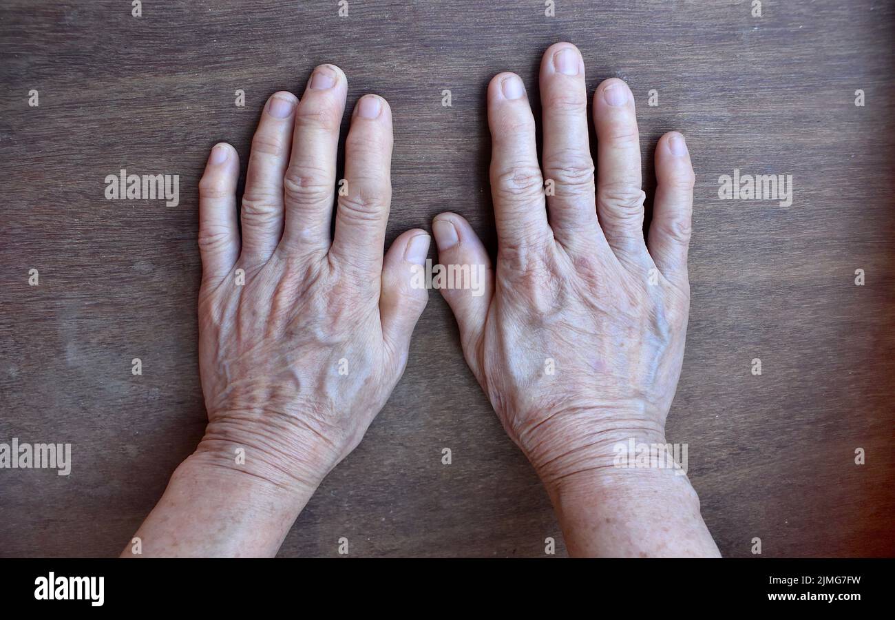 Wrinkles and veins on the hand of Asian elder woman. Concept of aging ...