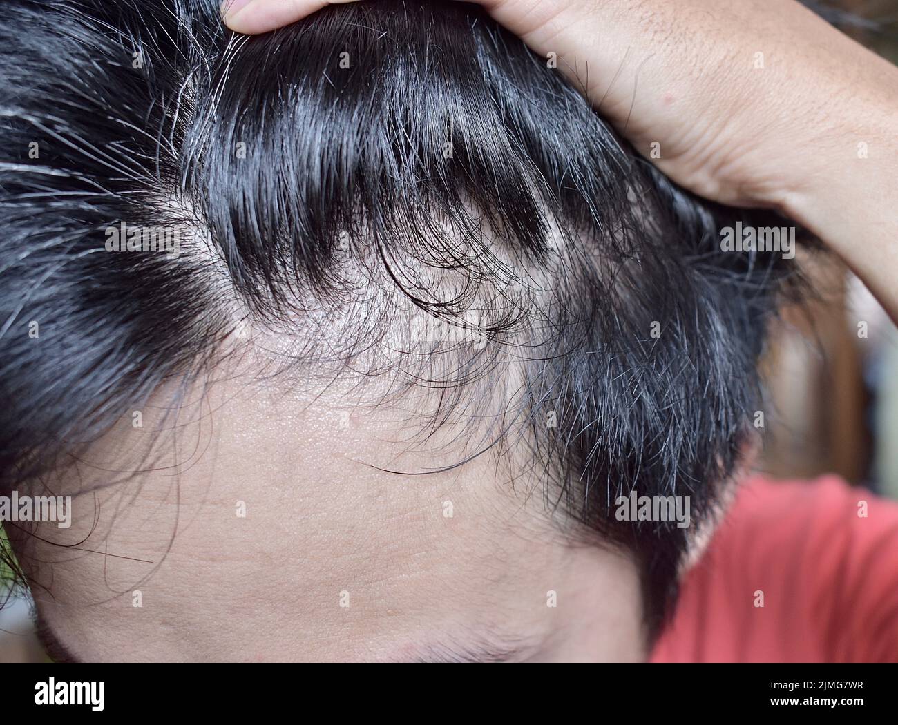 Thin thinning hi-res stock photography and images - Alamy
