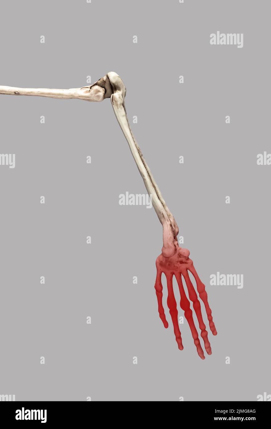Human skeleton arm with red hand. Fingers, palm pain. Joints ...