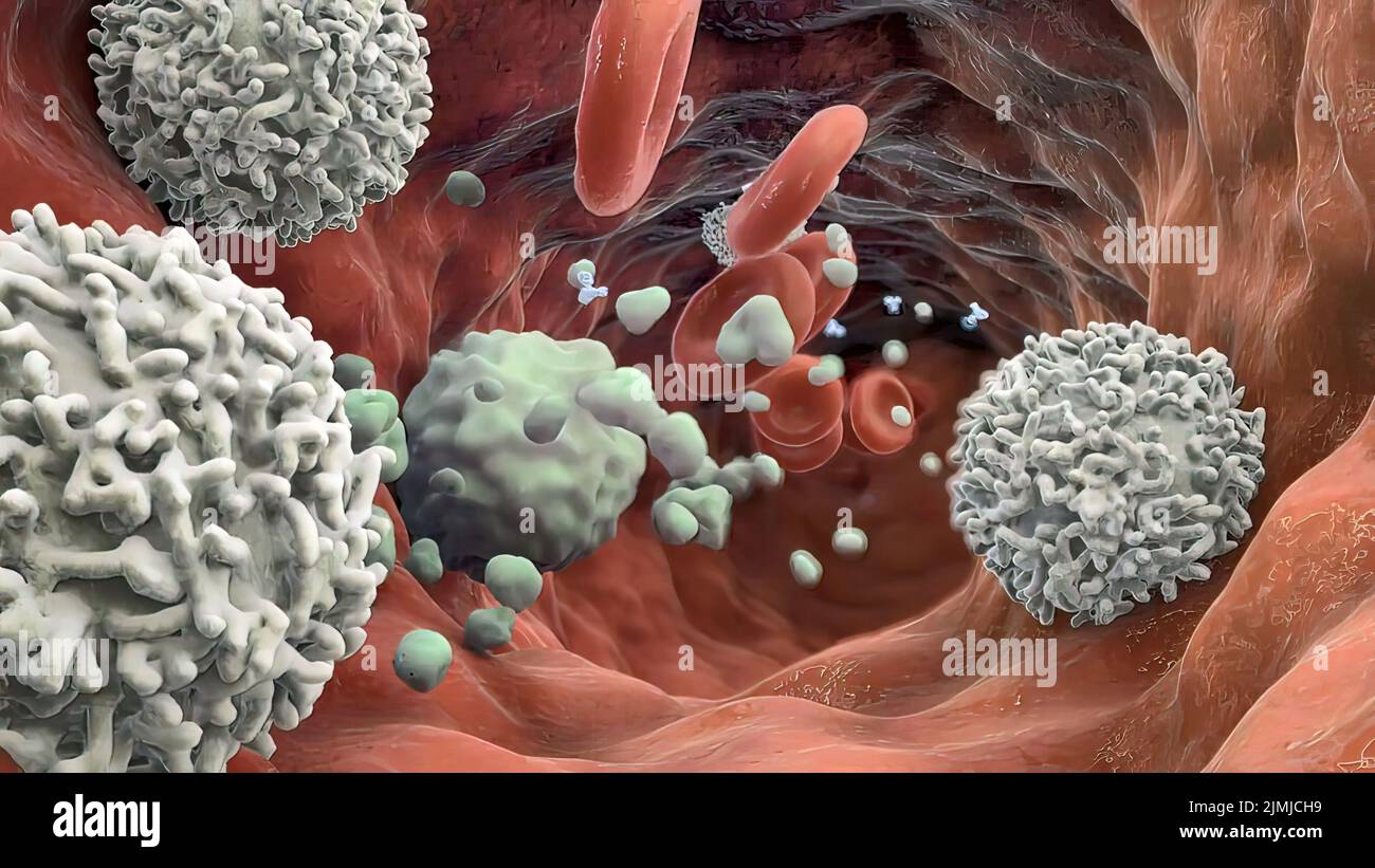 Damaged cells hi-res stock photography and images - Alamy