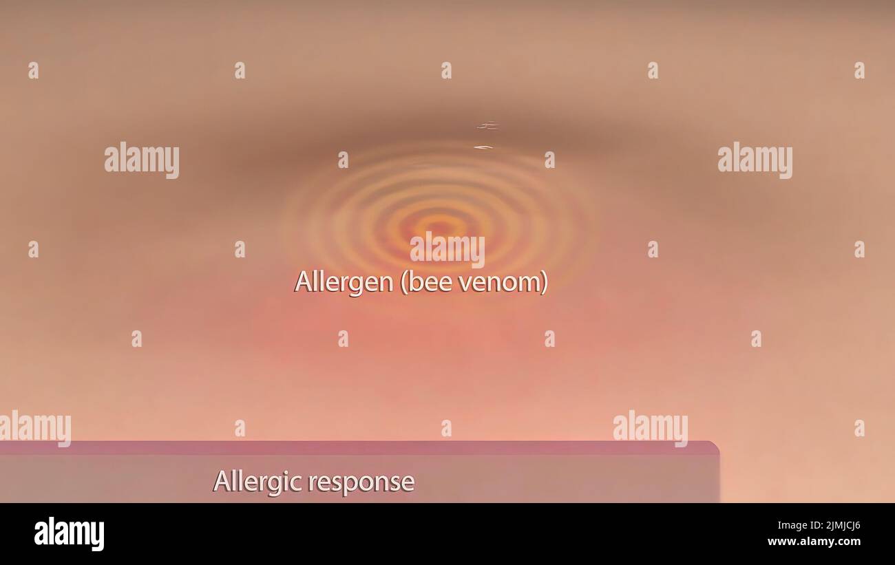 Human skin cell hi-res stock photography and images - Alamy