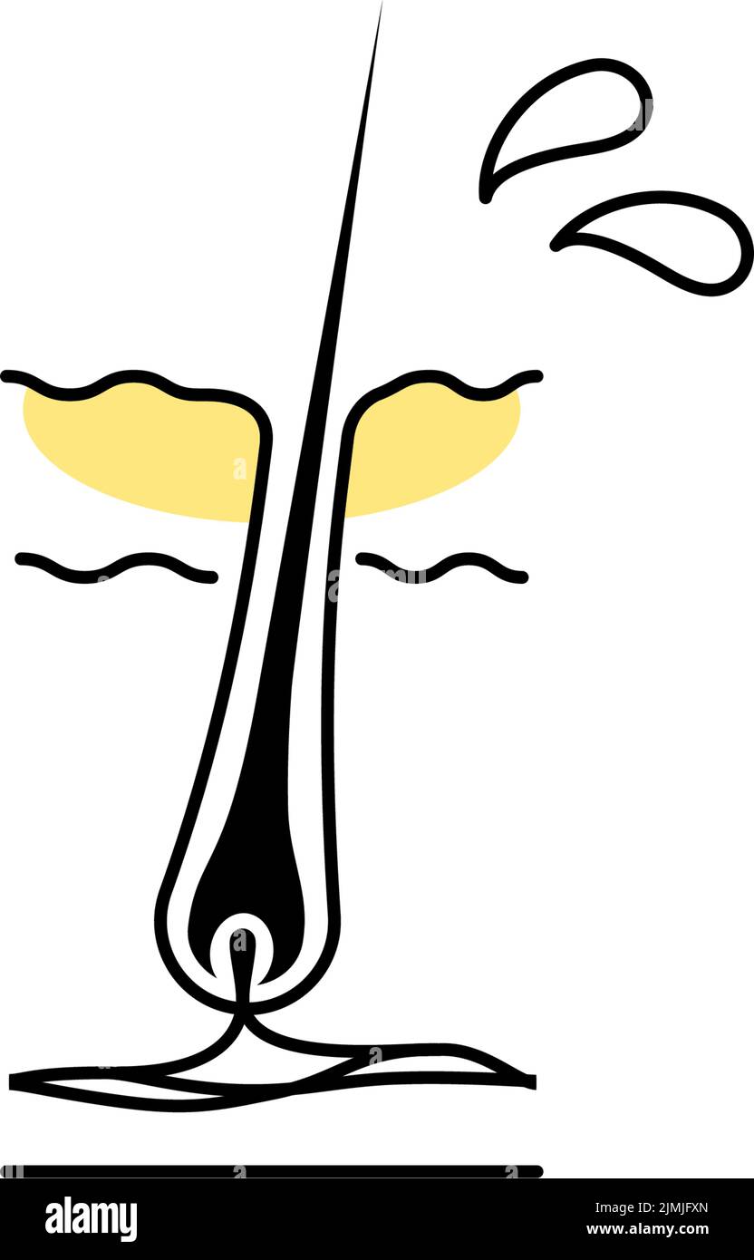 Illustration of rough skin, image of rough and inflamed skin surface ...