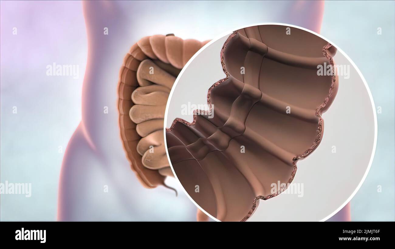 Large intestine camera hi-res stock photography and images - Alamy