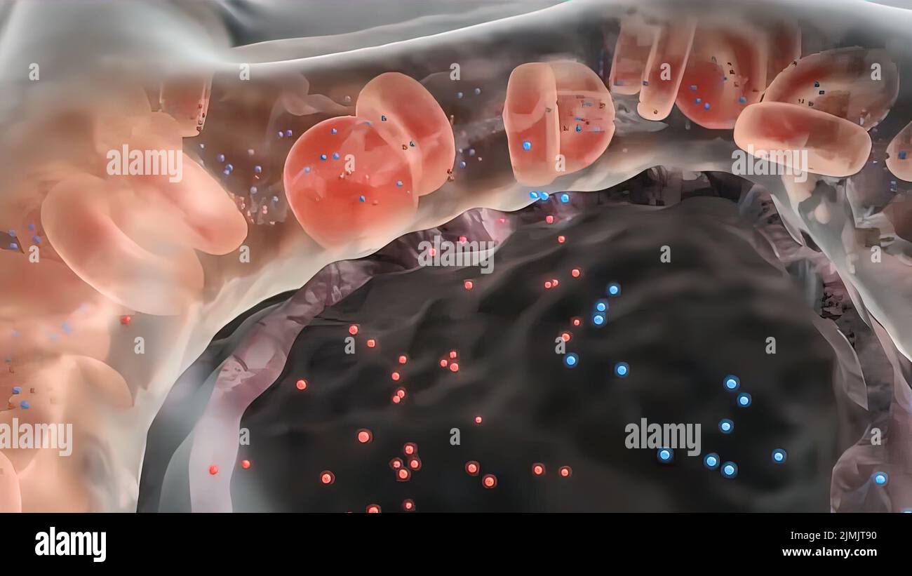 Genetic emphysema hi-res stock photography and images - Alamy