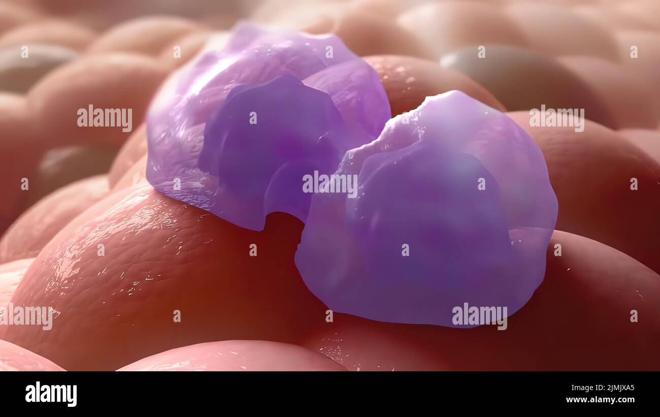 Diphtheria microscope hi-res stock photography and images - Alamy