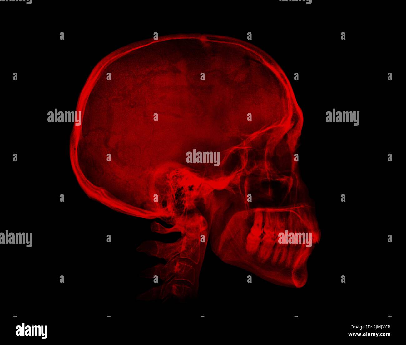 Human skull. Red X-ray image on black background Stock Photo - Alamy