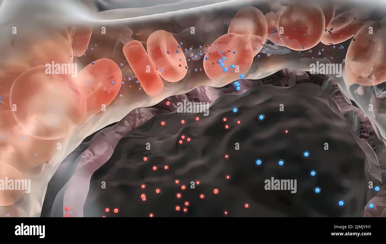 Emphysema hi-res stock photography and images - Alamy