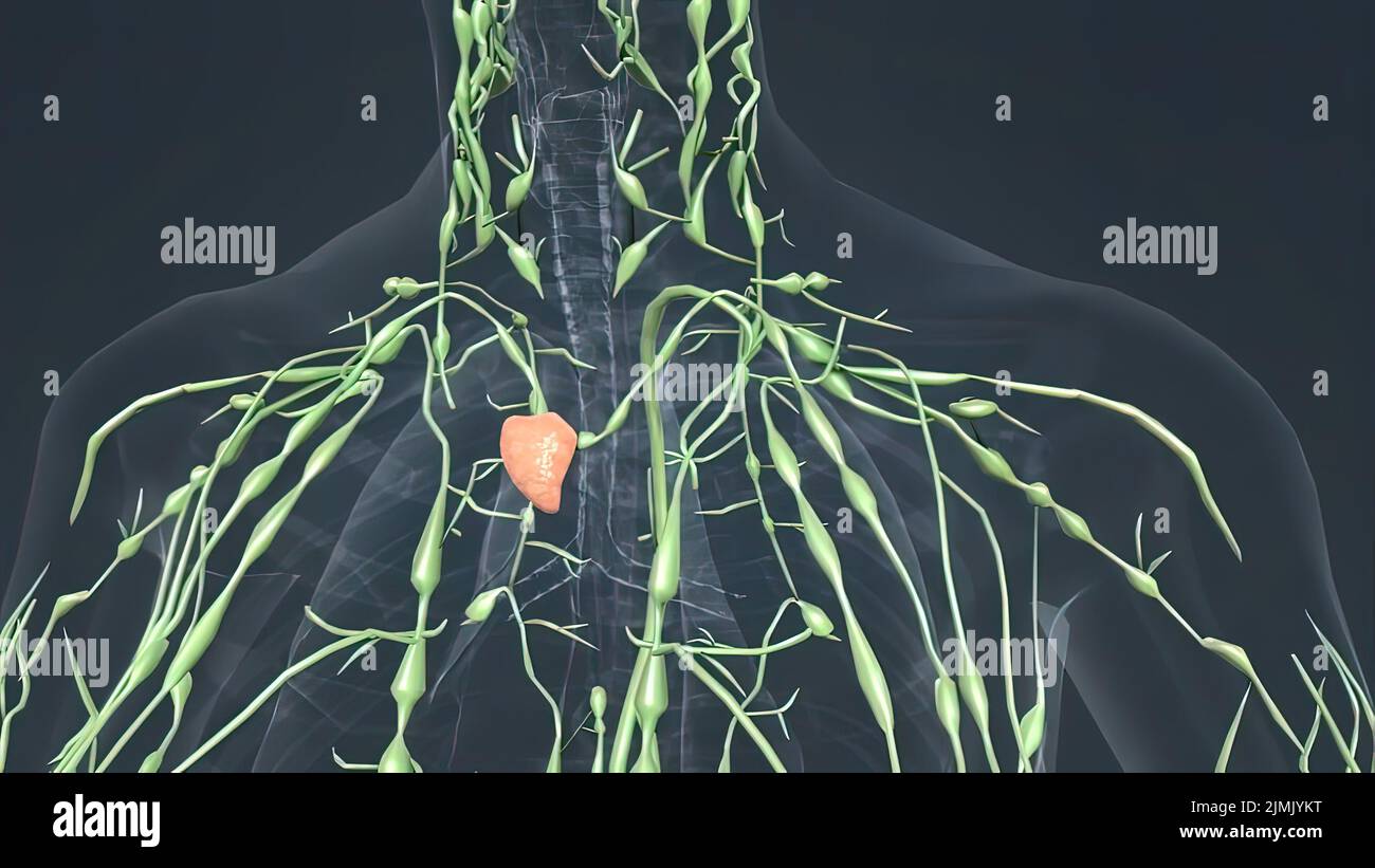 Lymph node swollen hi-res stock photography and images - Alamy