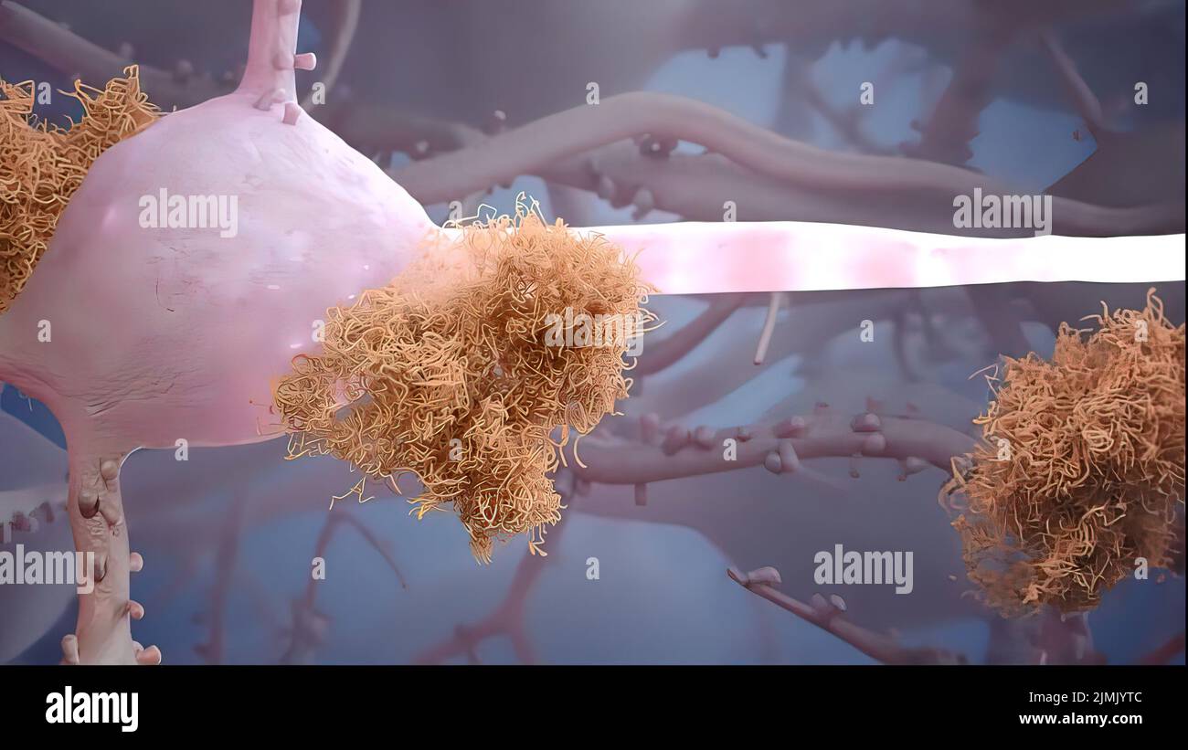 Neuroactivity hi-res stock photography and images - Alamy