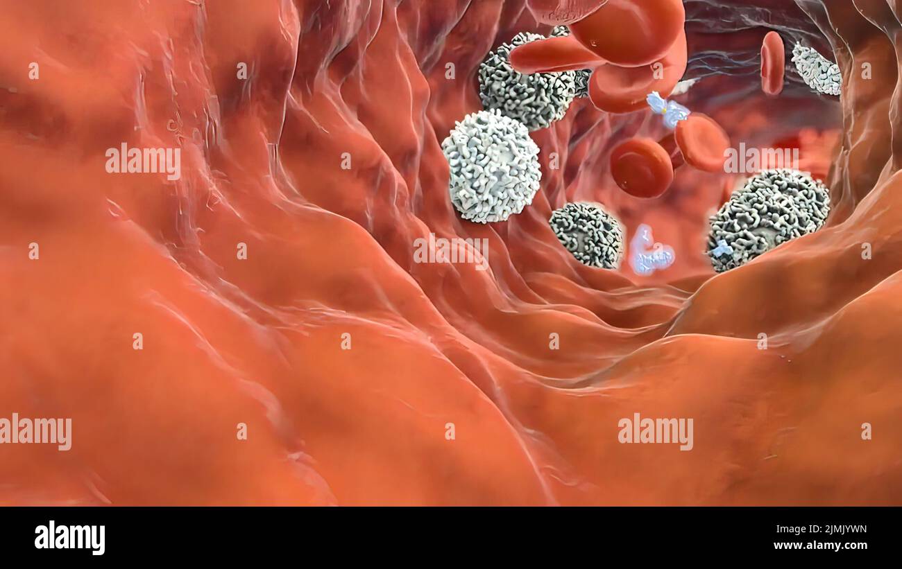 Damaged cells hi-res stock photography and images - Alamy